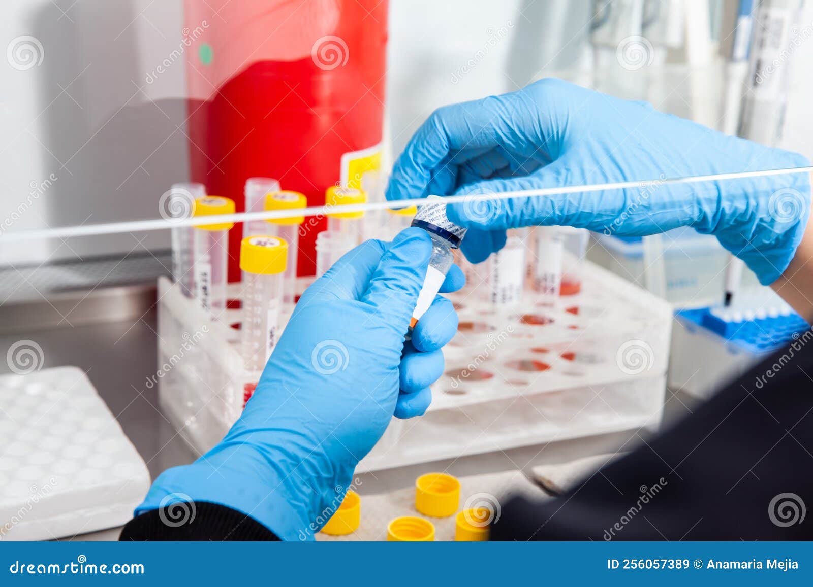 Scientist Preparing Blood Samples for Karyotype and Fluorescence in ... Scientist Preparing Blood Samples for Karyotype and Fluorescence in ...