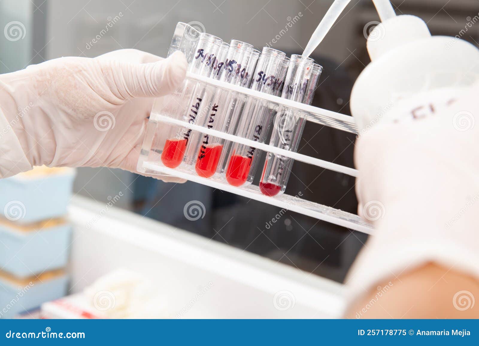 Scientist Preparing Bone Marrow Samples for Flow Cytometric Analysis in ...