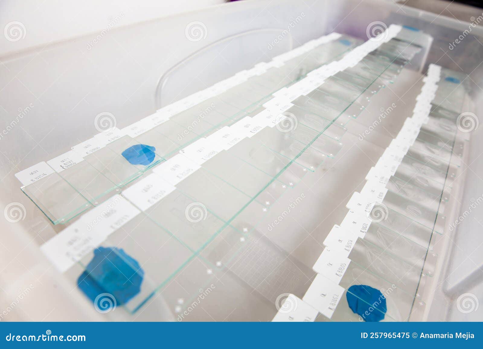Scientist Preparing Slides with Paraffin Embedded Tissue Samples for ...