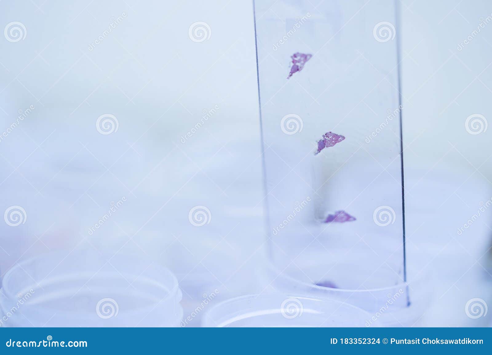 Scientist is Preparing a Tumor Slide. Microscopy of Cytopathology ...