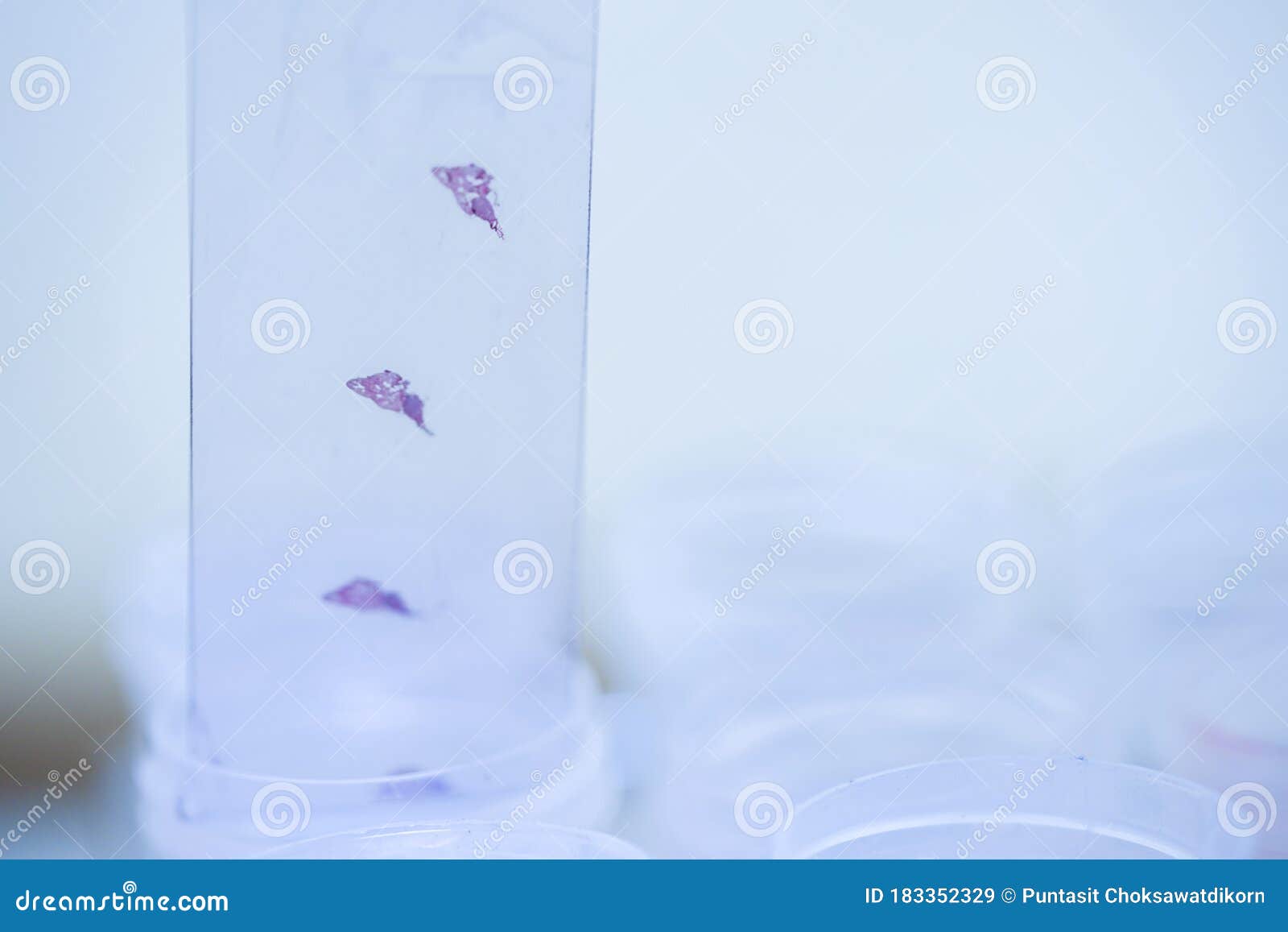 Preparing Histology Samples In A Pathology Lab. Royalty-Free Stock ...