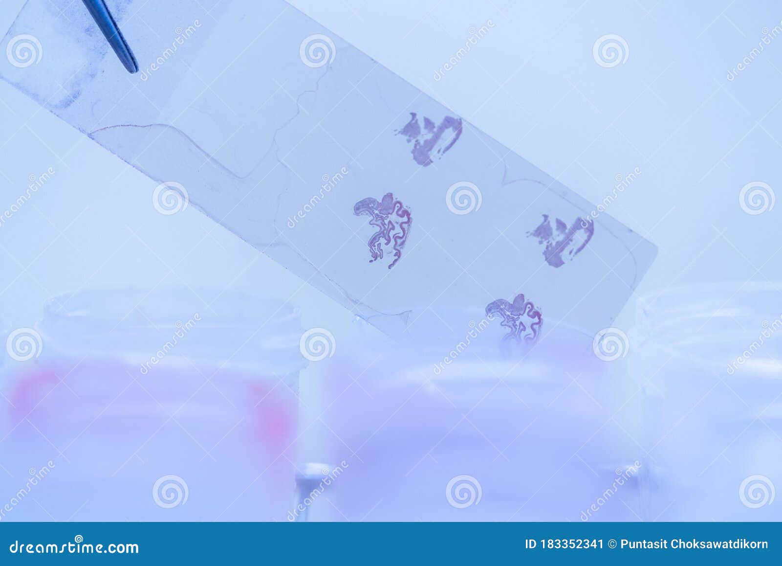 Preparing Histology Samples In A Pathology Lab. Royalty-Free Stock ...