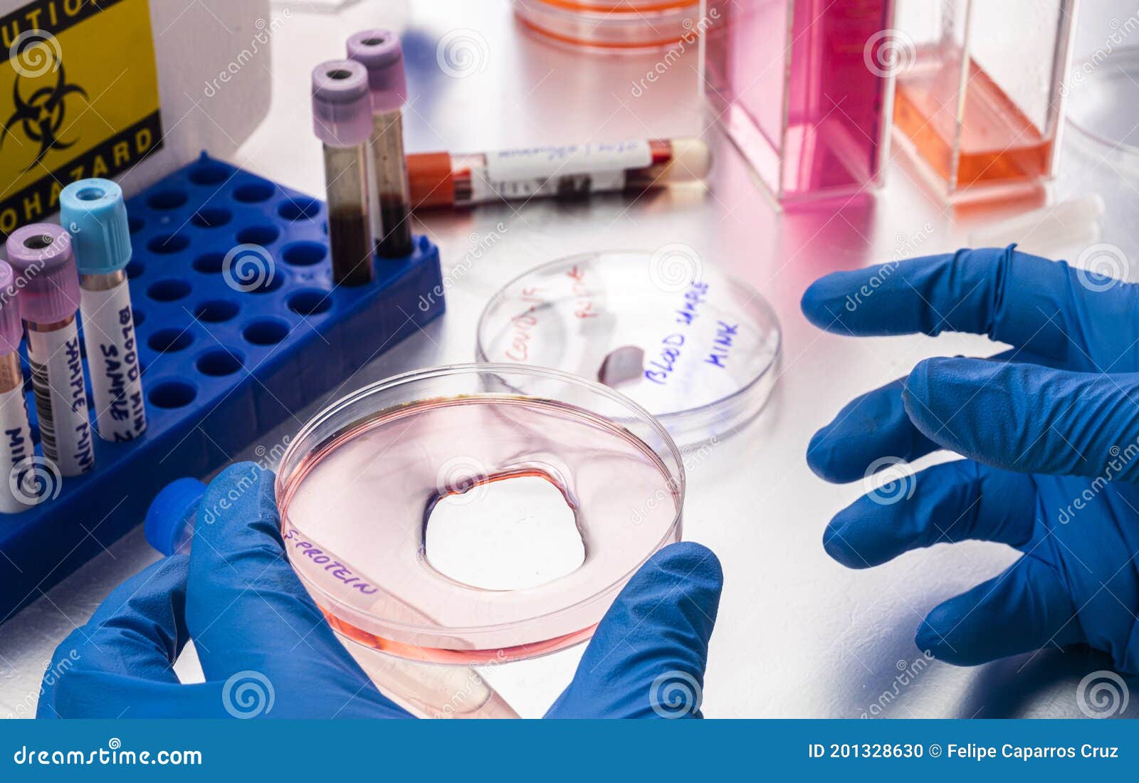 Scientist Researching Petri-disk S-protein Samples in a Laboratory ...