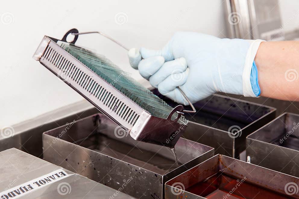 Scientist Staining Microscope Slides for Cytology Studies in the ...