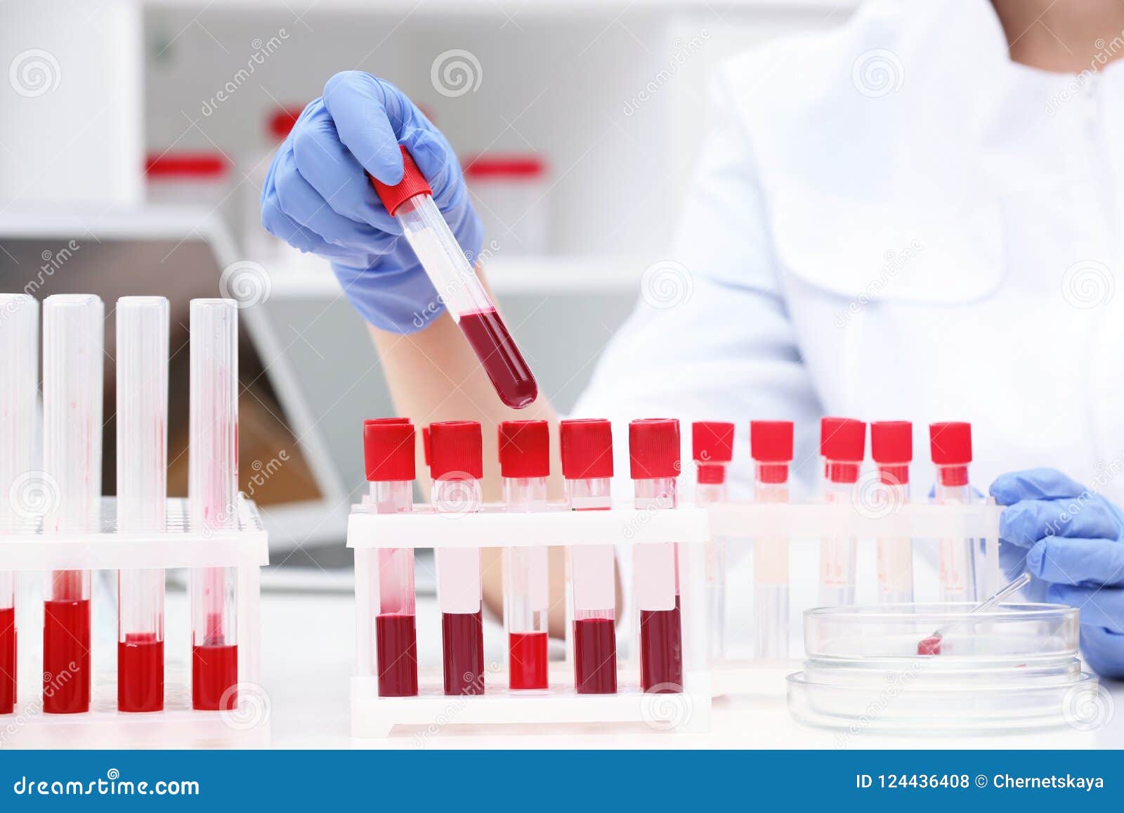 Scientist Working with Blood Samples in Test Tubes Stock Photo - Image ...