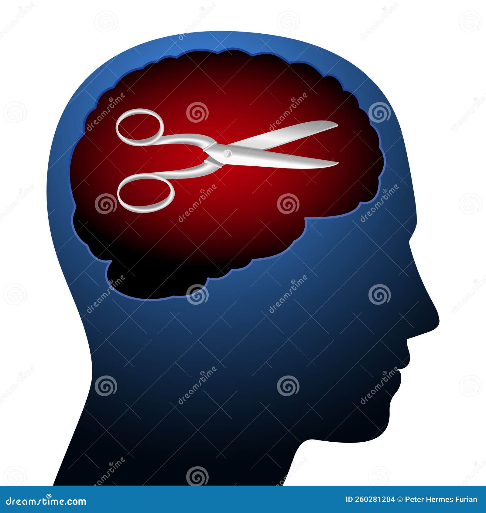 The Scissors In The Head, A Symbol And Metaphor For Self-censorship ...