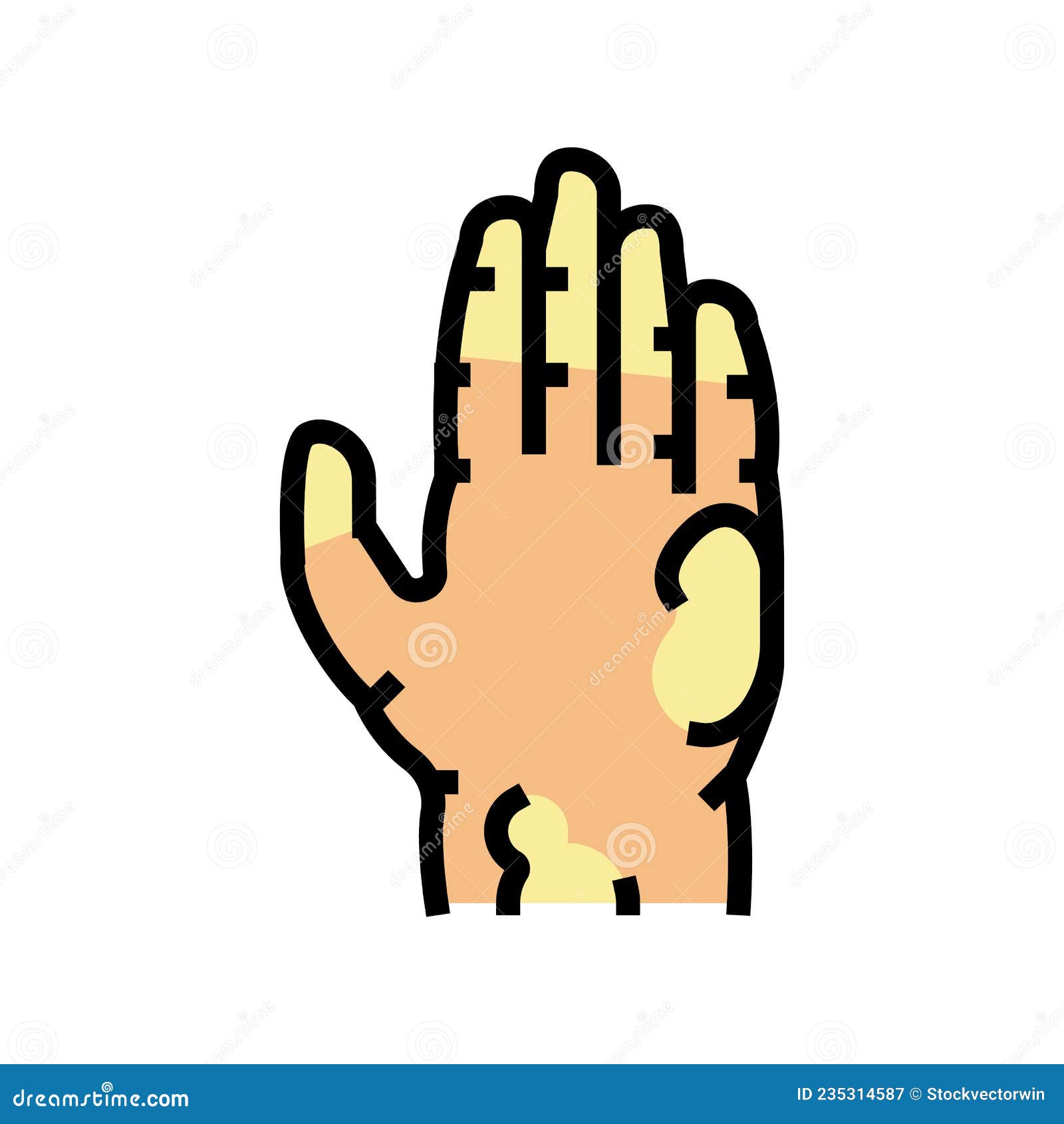 Scleroderma Skin Disease Color Icon Vector Illustration Stock Vector ...