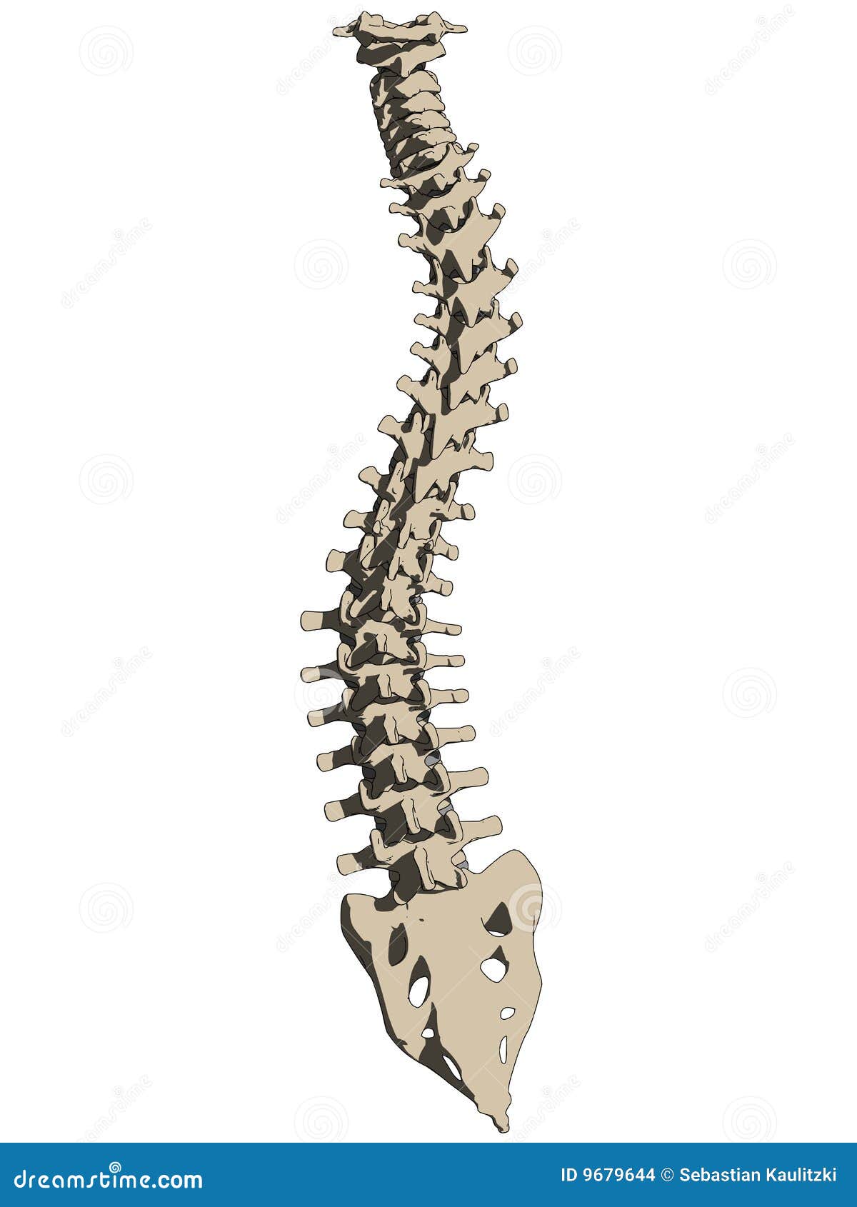 Scoliosis Cartoon Vector | CartoonDealer.com #9679627