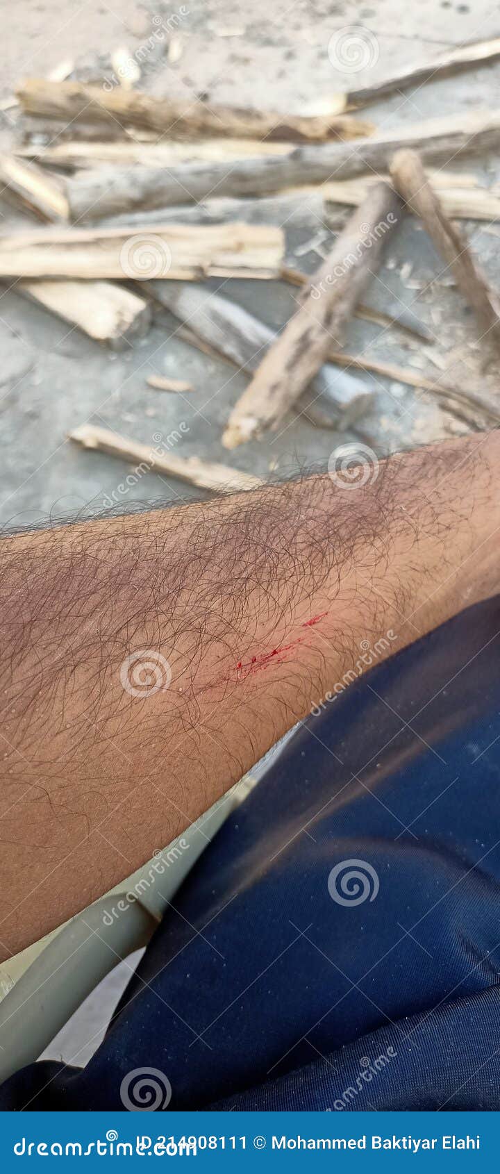 Scratch while Breaking Fire Wood Stock Image - Image of limb, footwear ...