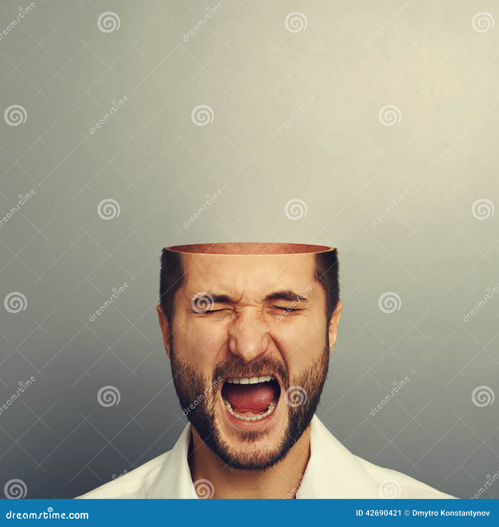 In The Man`s Open Head, The Brain Glues Stickers To Itself. The Concept ...