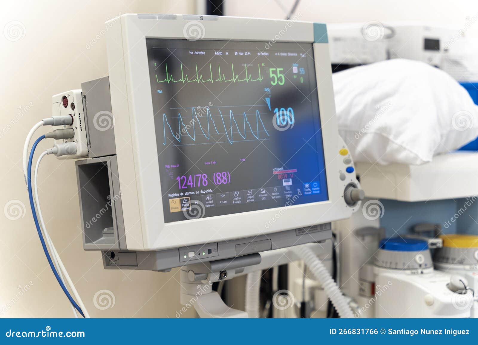 Screen of a Cardiac Machine in a Hospital Room Editorial Photo - Image ...