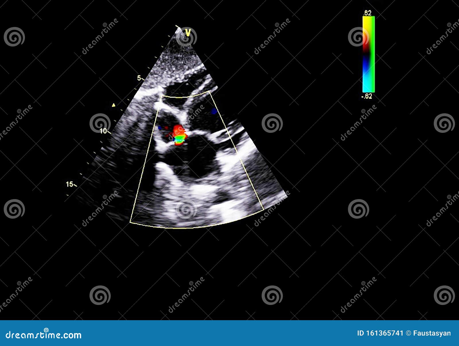 Screen of Echocardiography Ultrasound Machine Stock Image - Image of ...