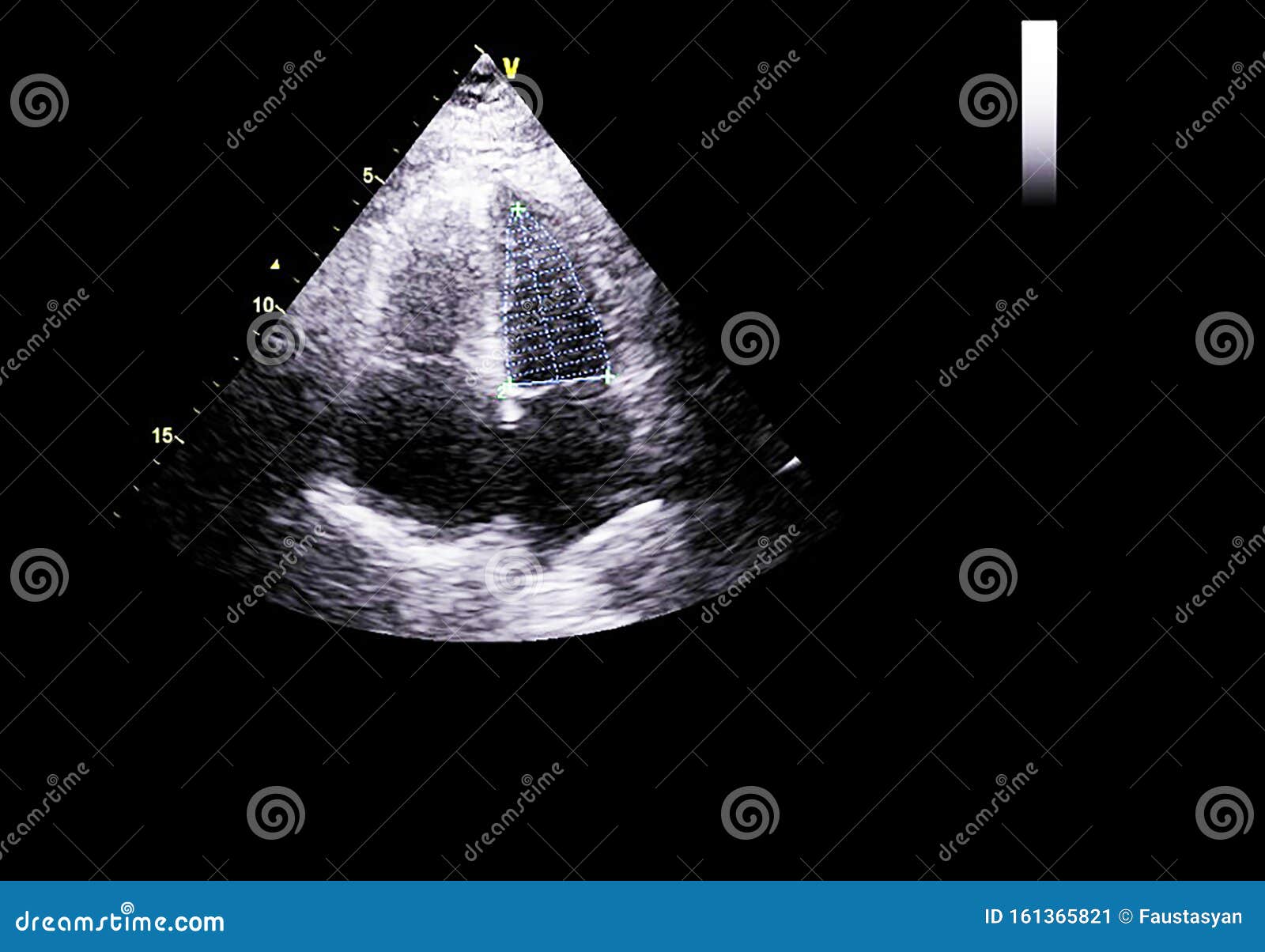 Screen of Echocardiography Ultrasound Machine Stock Image - Image of ...