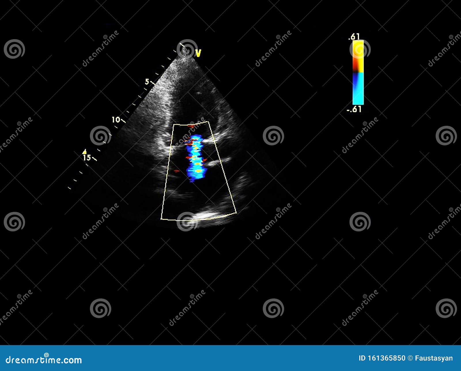 Screen of Echocardiography Ultrasound Machine Stock Photo - Image of ...