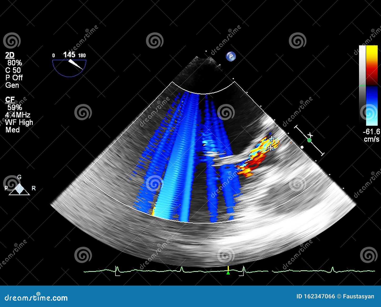 Screen of Echocardiography Ultrasound Machine Stock Photo - Image of ...