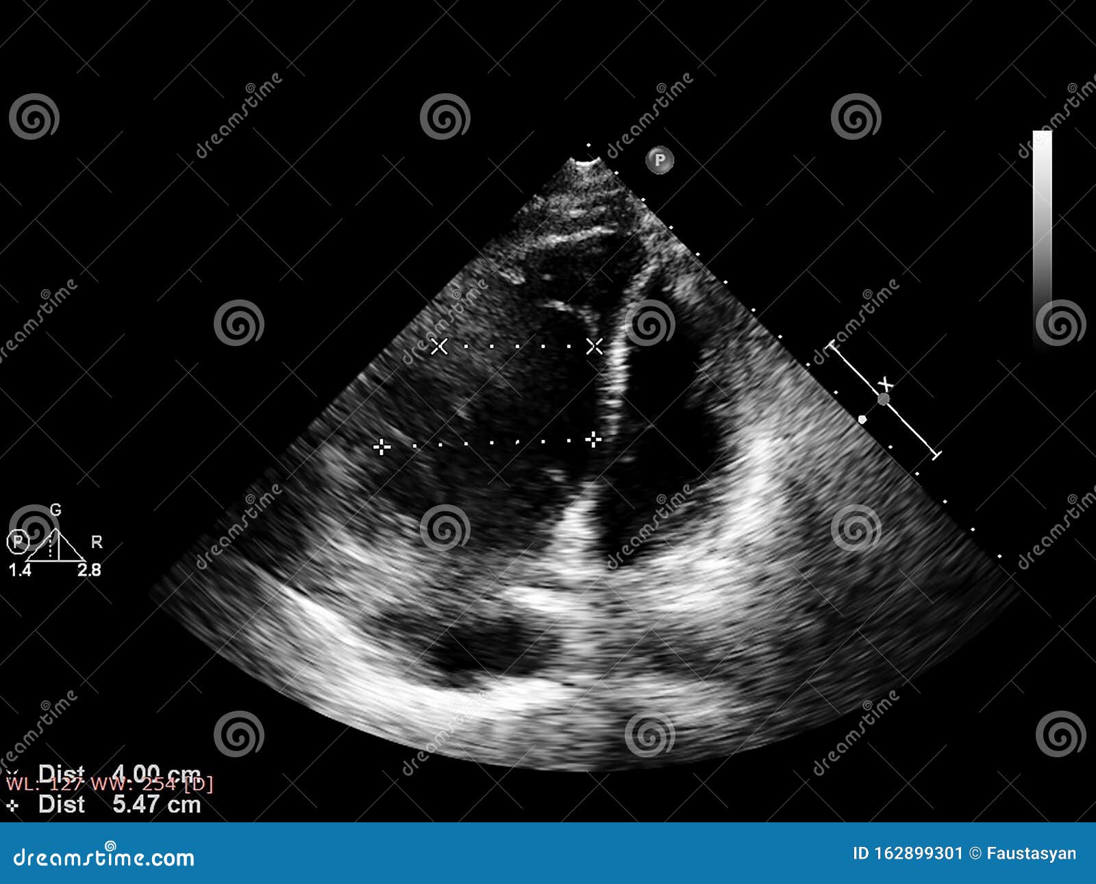 Screen of Echocardiography Ultrasound Machine Stock Image - Image of ...