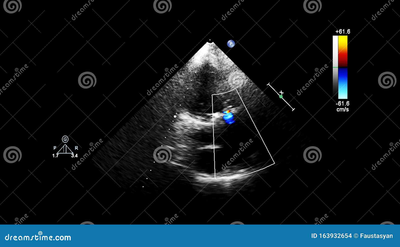 Screen of Echocardiography Ultrasound Machine Stock Photo - Image of ...