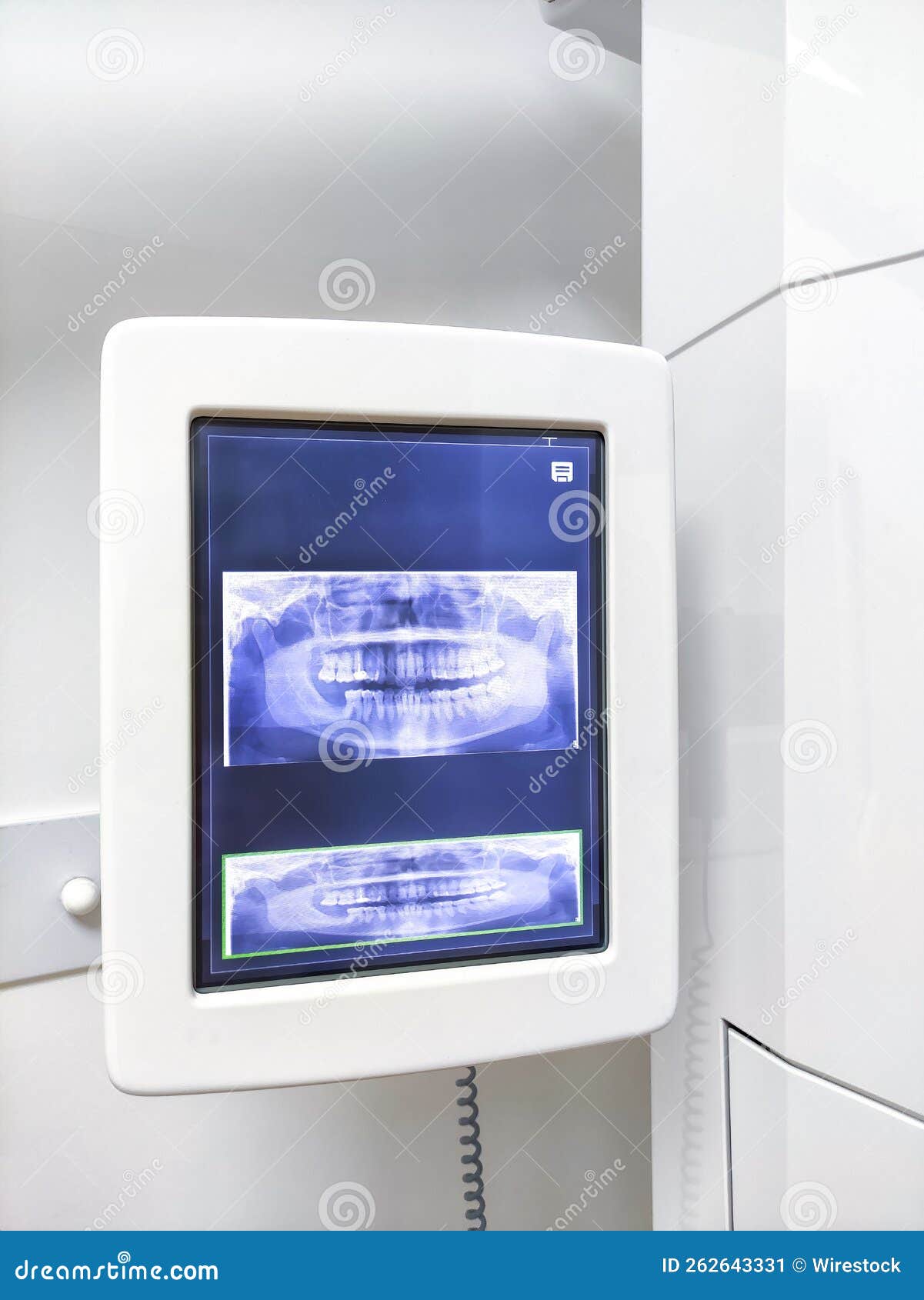 Screen of the Teeth Scan Machine in the Dental Clinic. Stock Image ...