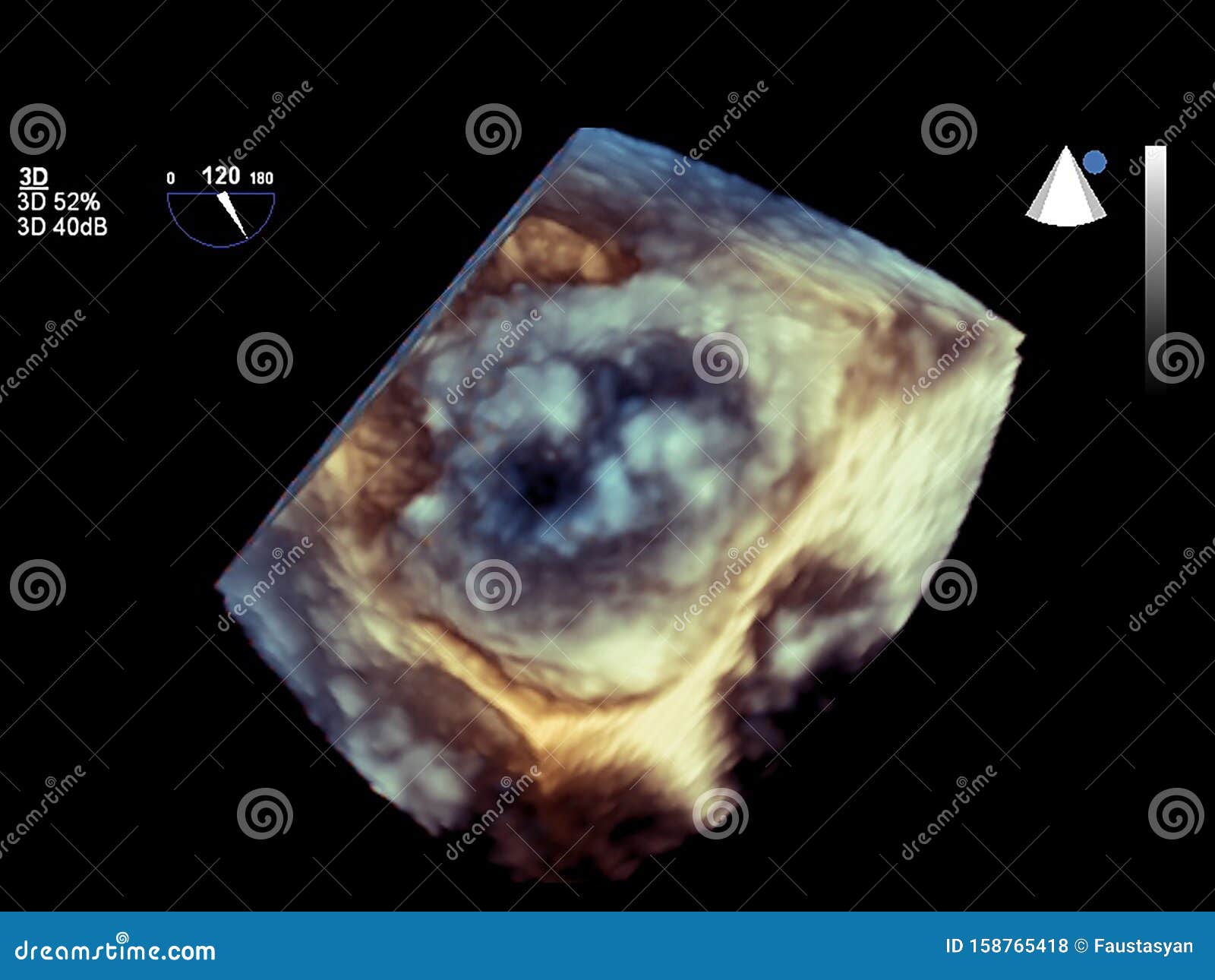 Modern 3D echocardiography stock illustration. Illustration of focus ...