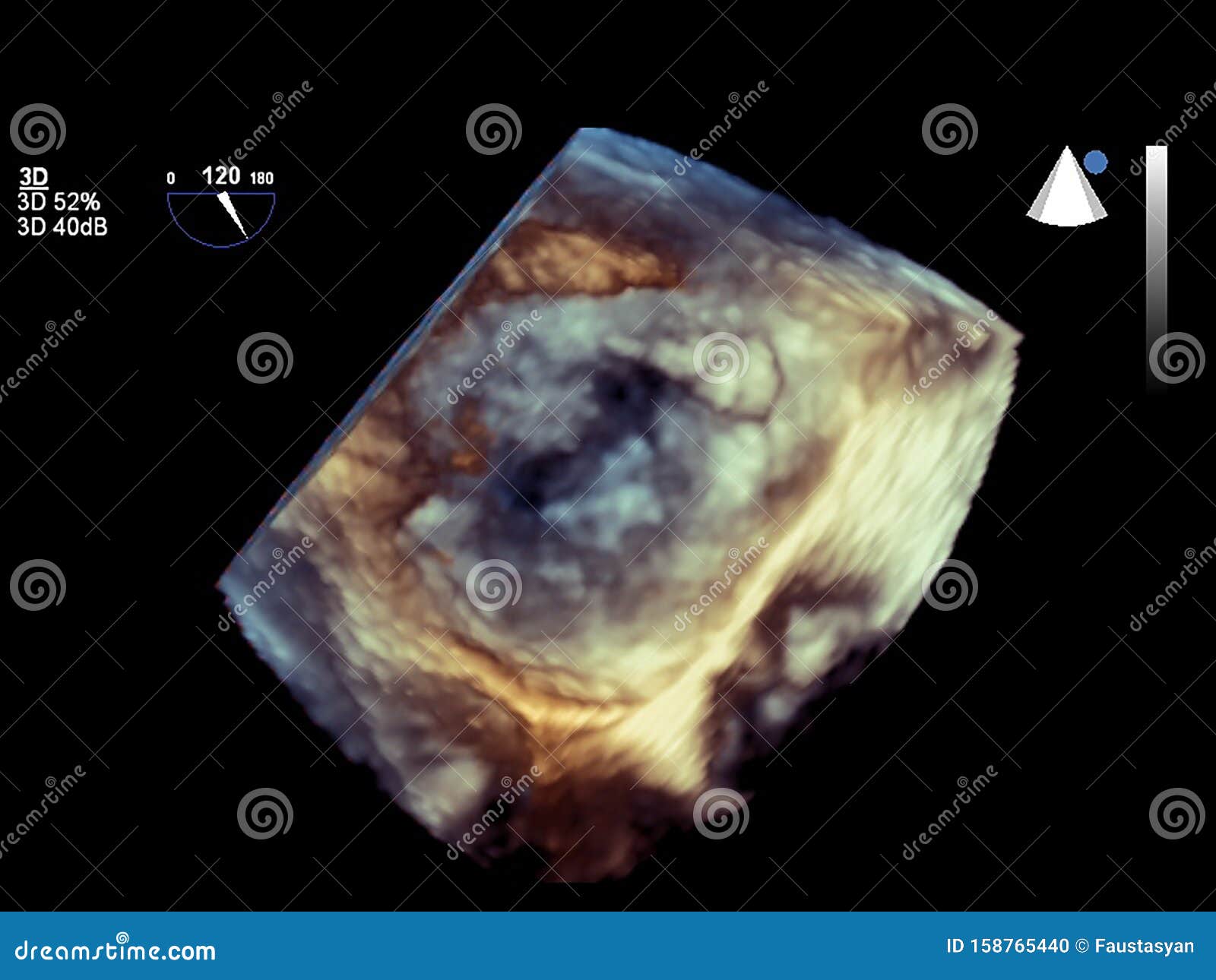 Modern 3D echocardiography stock illustration. Illustration of advanced ...