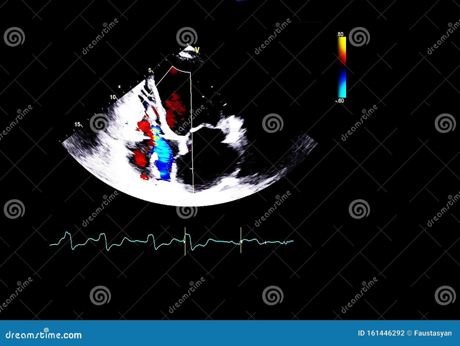 Screen of Echocardiography Ultrasound Machine Stock Photo - Image of ...