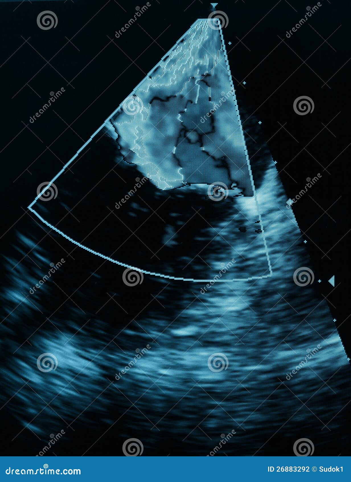 Screen Ultrasound Machine. Symbol Diagnostics in Healthcare. Stock ...