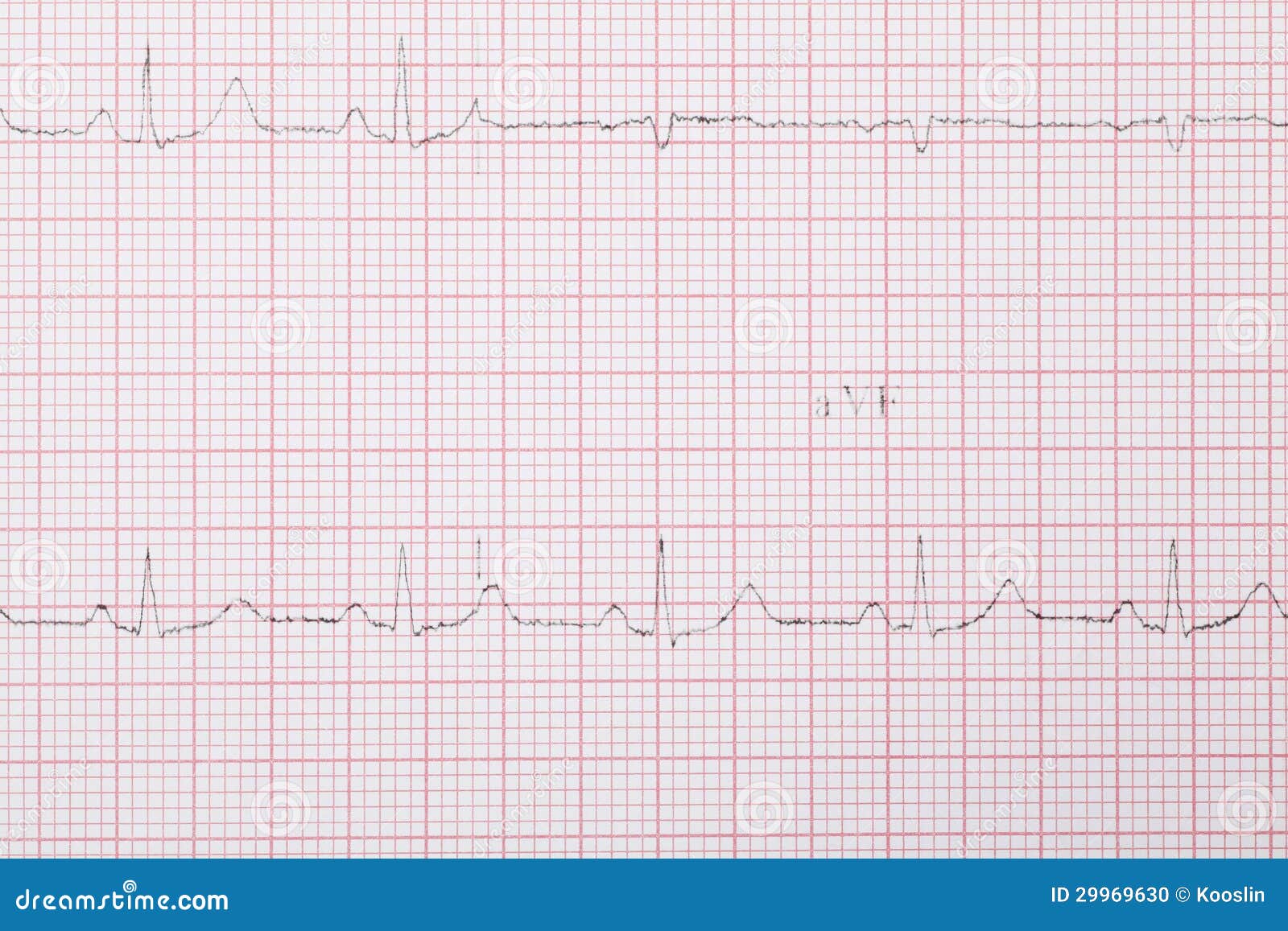Cardiogram stock photo. Image of paper, heartbeat, care - 29969630