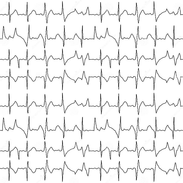 Seamless Pattern of the Ekg Cardiograms Chart Stock Vector ...
