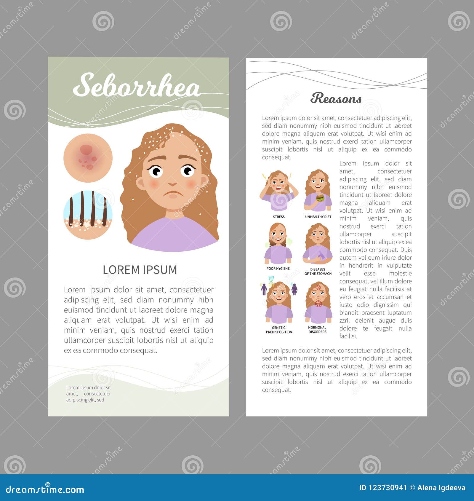 Seborrhea infographic ilustración del vector. Ilustración de hongo ...