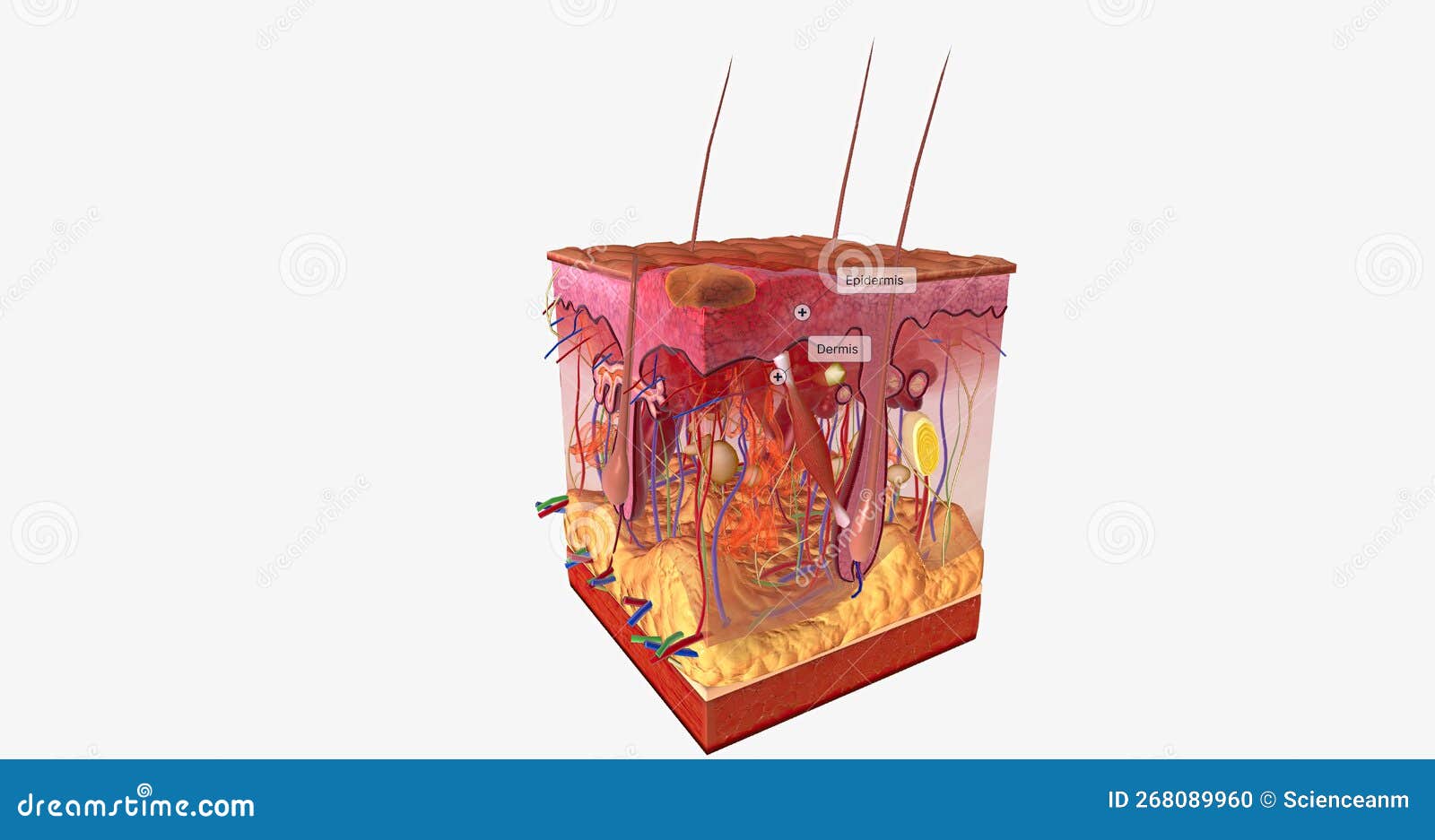 A Second Degree Burn Will Affect the Epidermis and Part of the Dermis ...