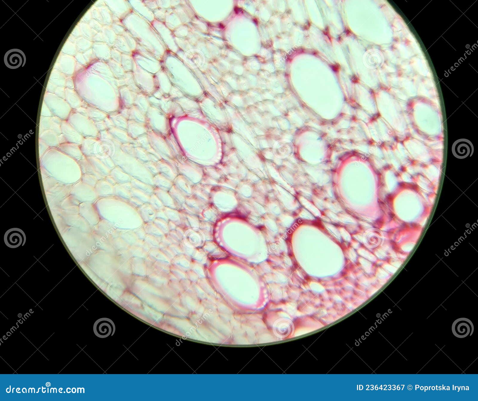 Secondary Root Structure, Permanent Microscopic Photography Stock Image ...