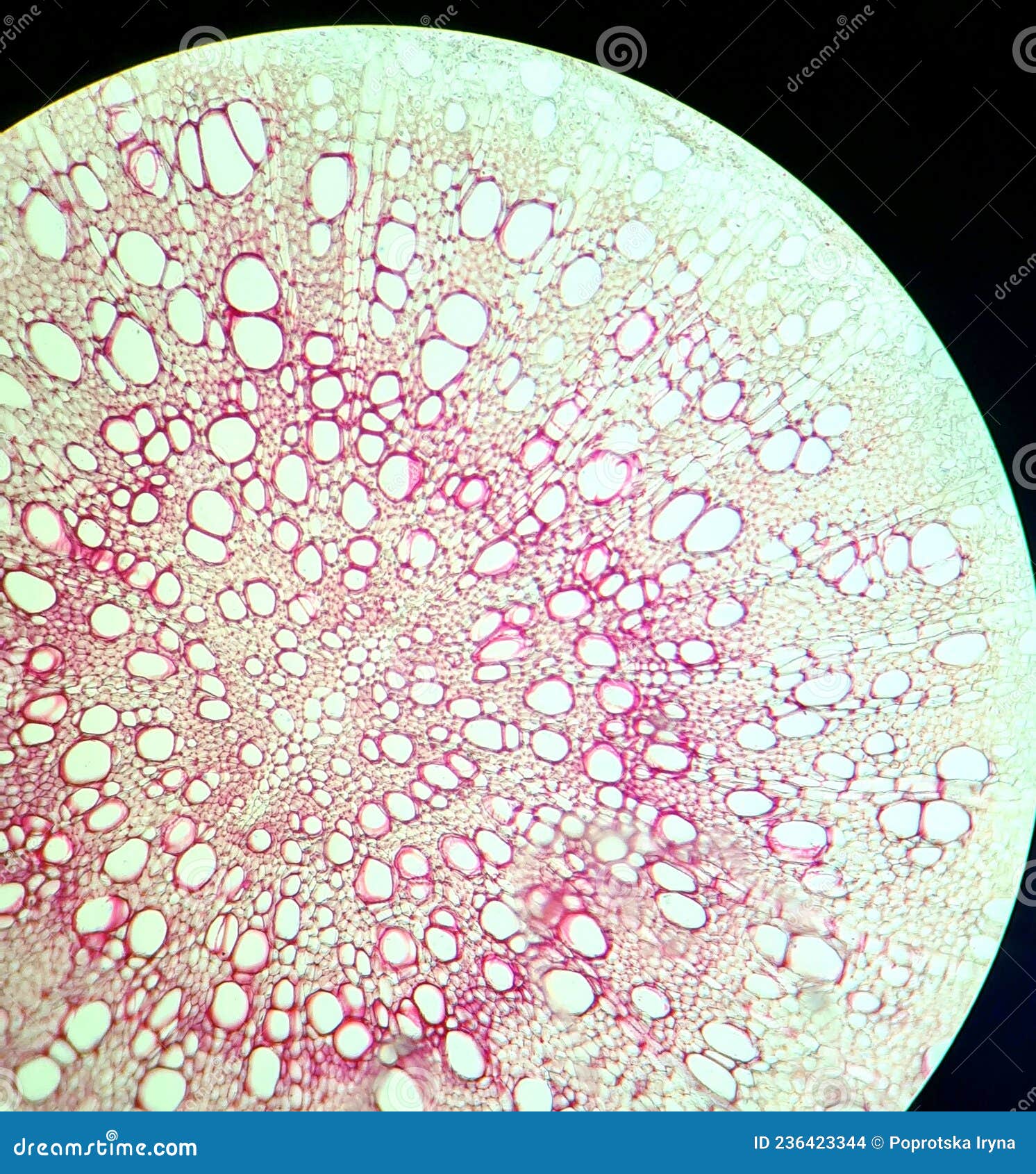 Secondary Root Structure, Microscopic Photography Stock Photo - Image ...