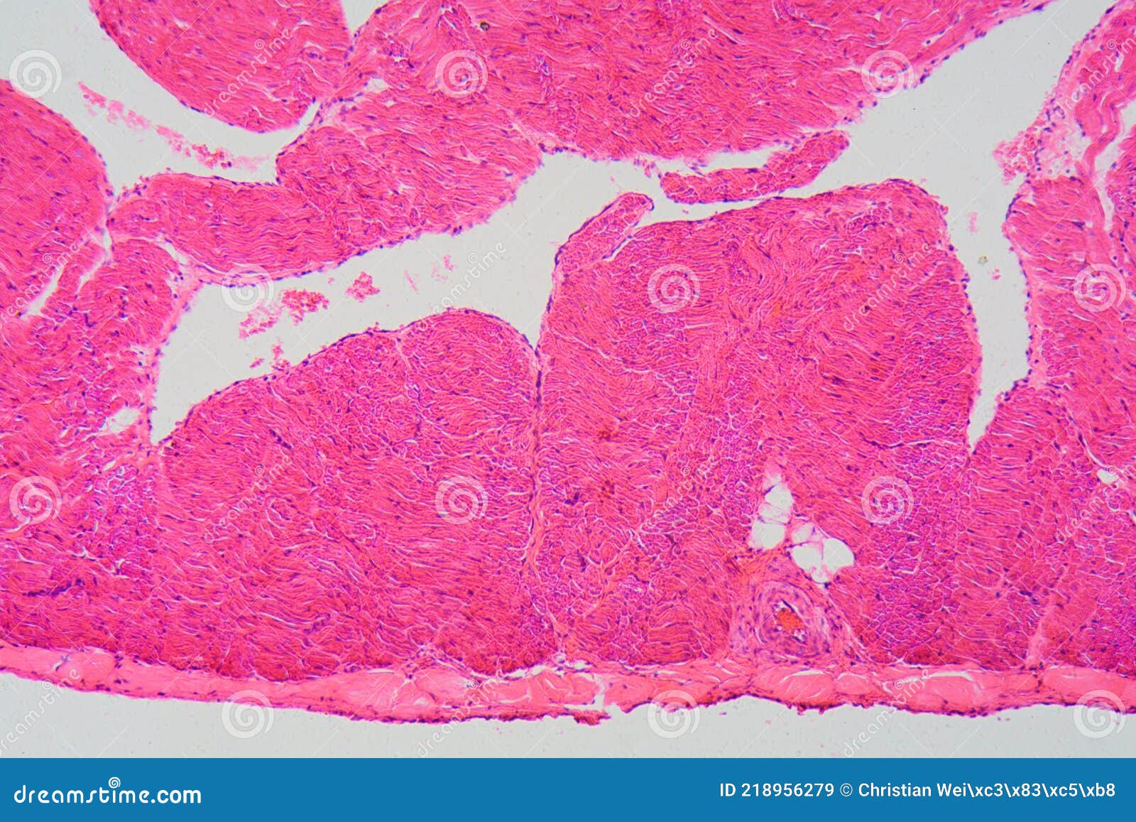Atrial Wall of a Human Heart in the Microscope Stock Image - Image of ...