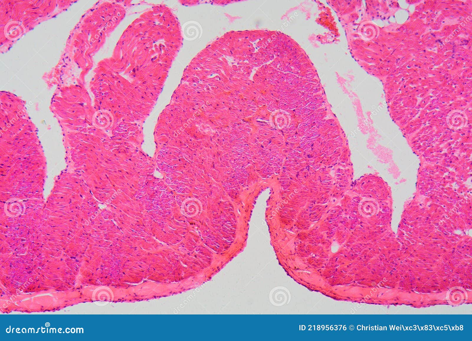 Human Heart Cells Under Microscope