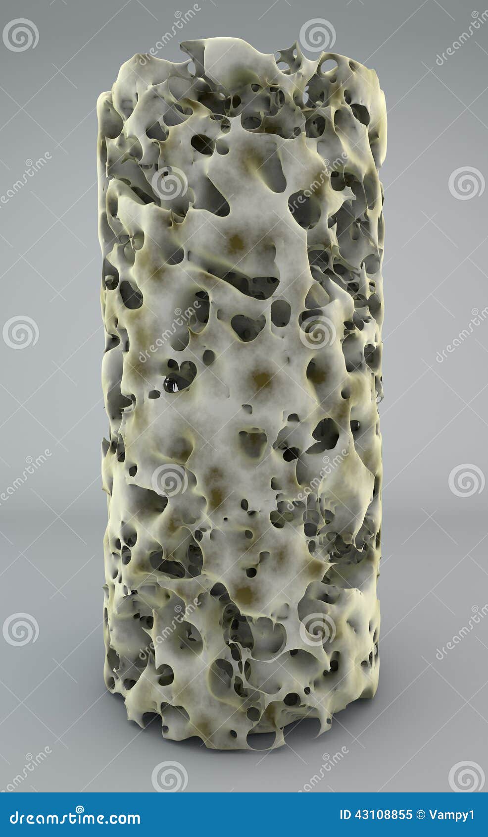 Section of Bone with Osteoporosis Stock Illustration - Illustration of ...