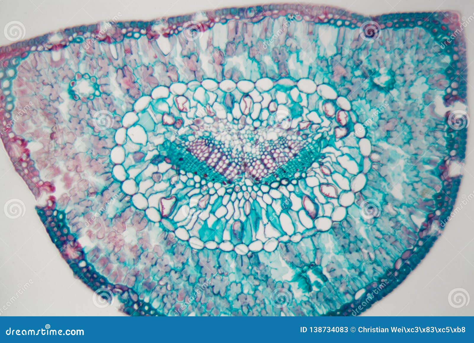 Conifer Needle with Environmental Damages Under a Microscope Stock ...