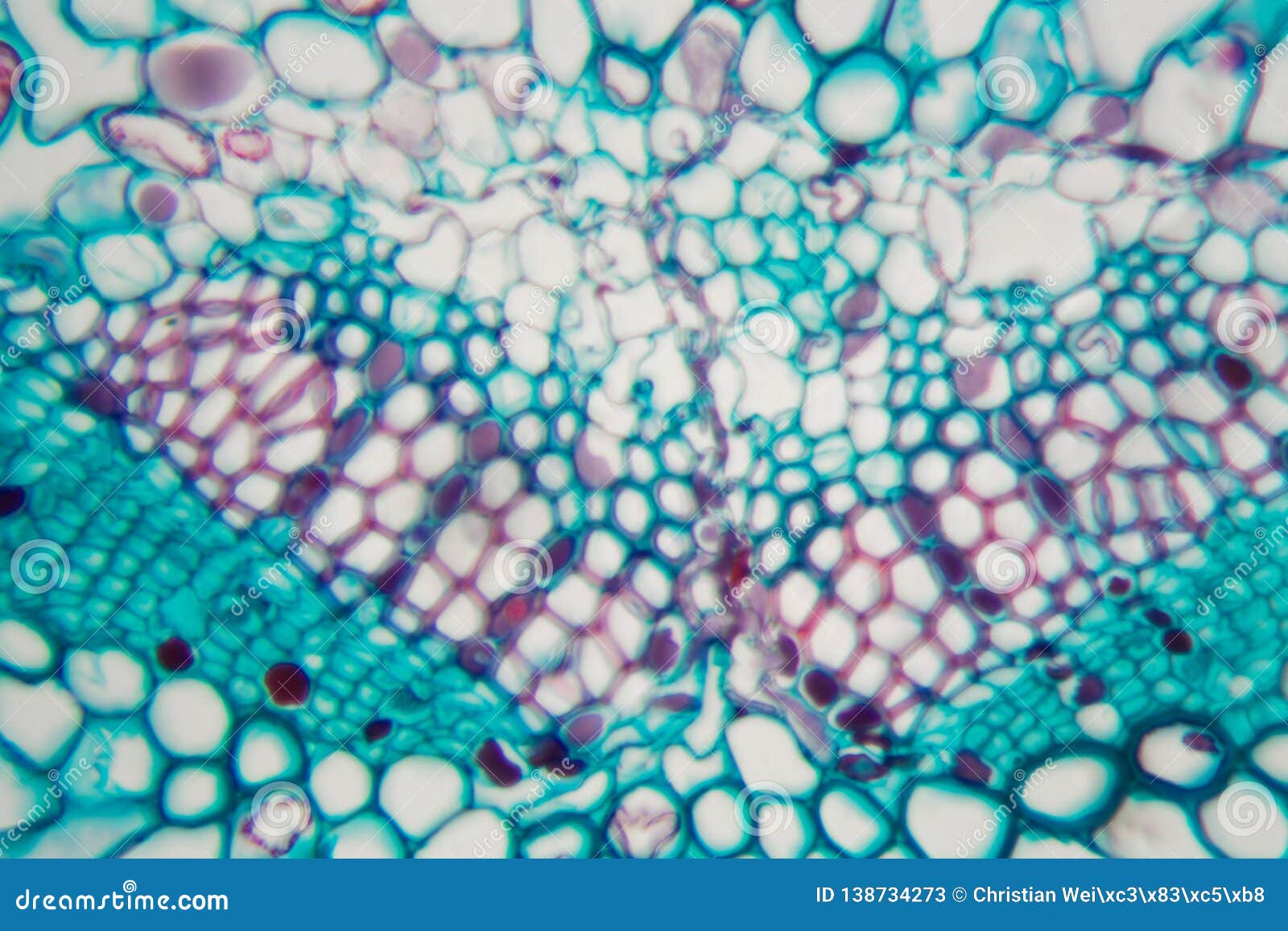 Conifer Needle with Environmental Damages Under a Microscope Stock ...