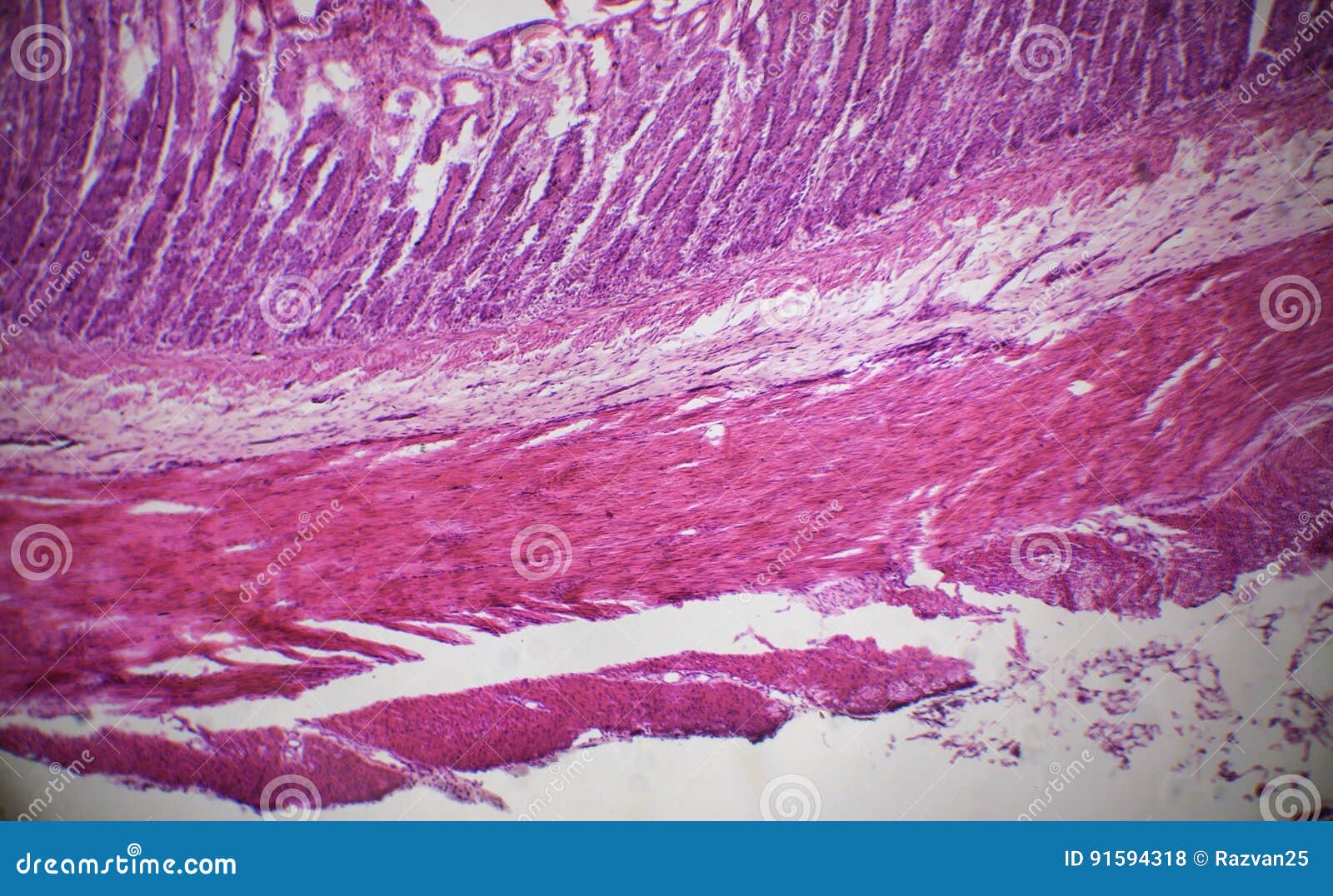 Section D'intestin Grêle Sous Le Microscope Photo stock - Image du sain ...