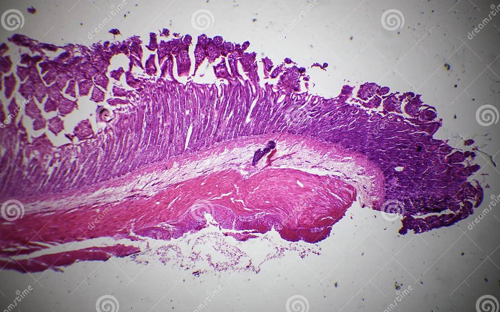 Section D'intestin Grêle Sous Le Microscope Photo stock - Image du ...