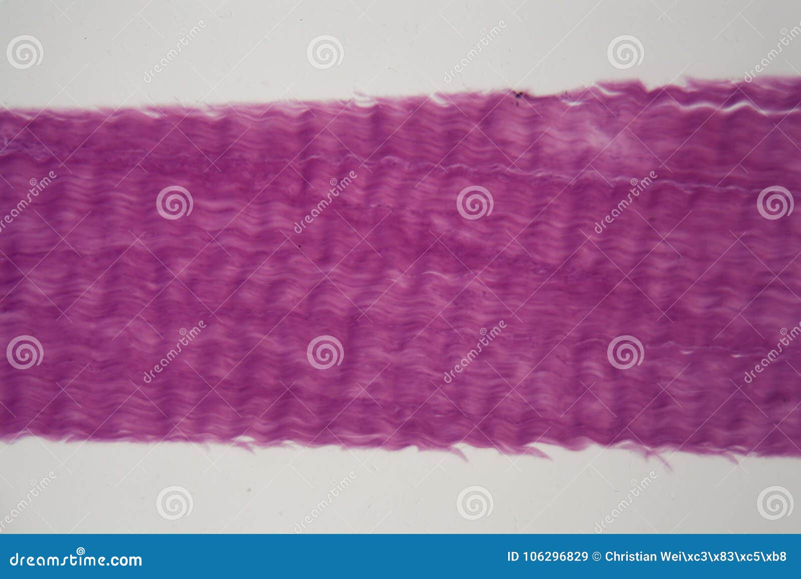 Section of Dense Connective Tissue Stock Image - Image of microscopical ...