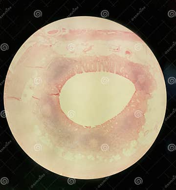 Cross Section through a Human Appendix Stock Image - Image of brown ...