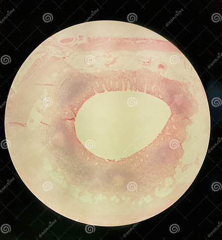 Cross Section through a Human Appendix Stock Image - Image of brown ...
