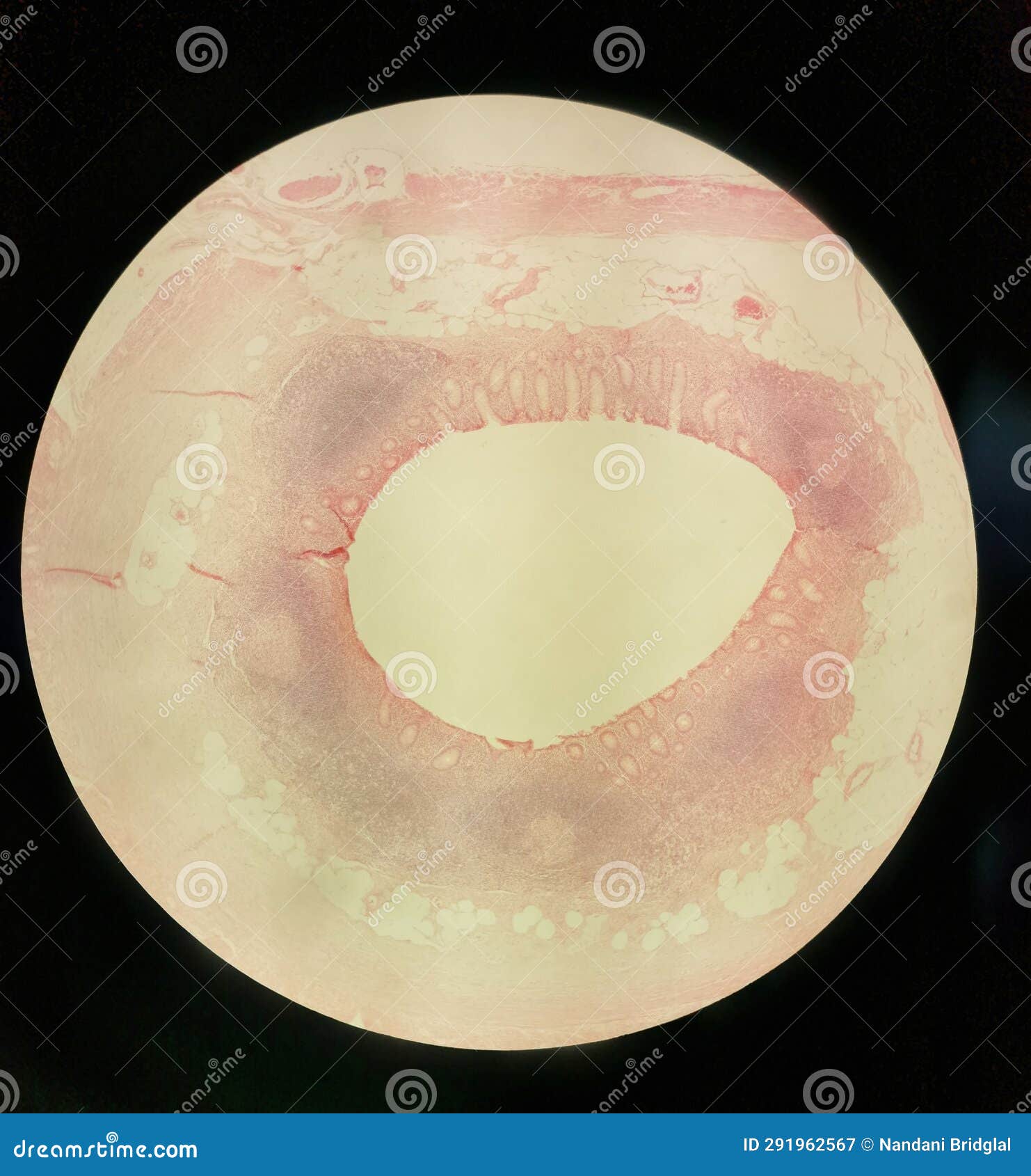 Cross Section Through A Human Appendix Royalty-Free Stock Photography ...