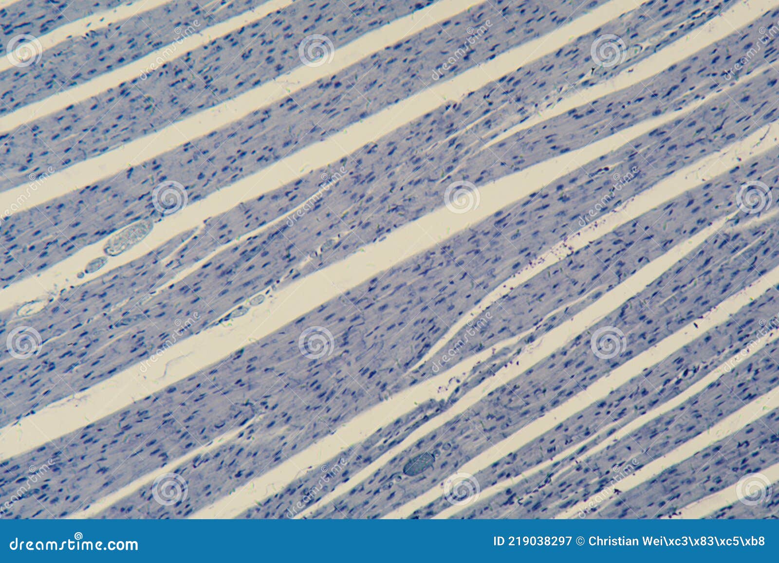Human Cardiac Muscle Under the Microscope Stock Image - Image of ...