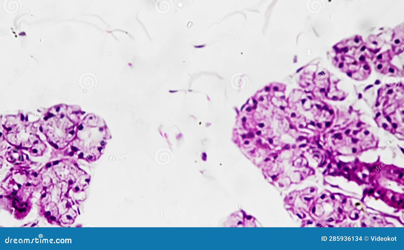 Section of Human Glandular Epithelium at Microscopic Slide 400x Filmed ...