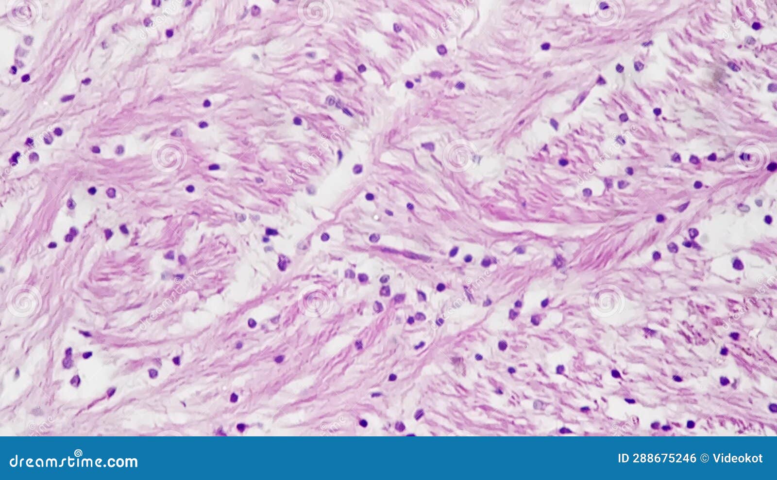 Section of Human Sensory Cortex Filmed Under Microscope 400x on Bright ...