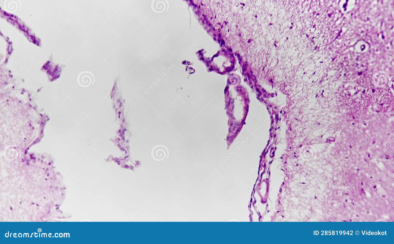 Section of Human Sensory Cortex Filmed Under Microscope 200x on Bright ...