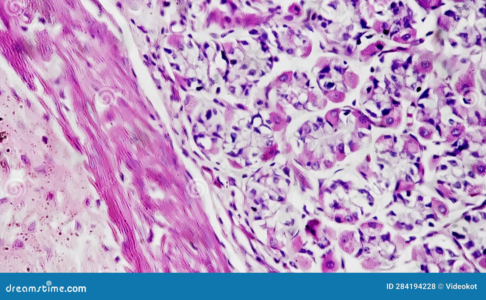 Section of Human Stomach Pattern Magnified in 400 Times Under ...