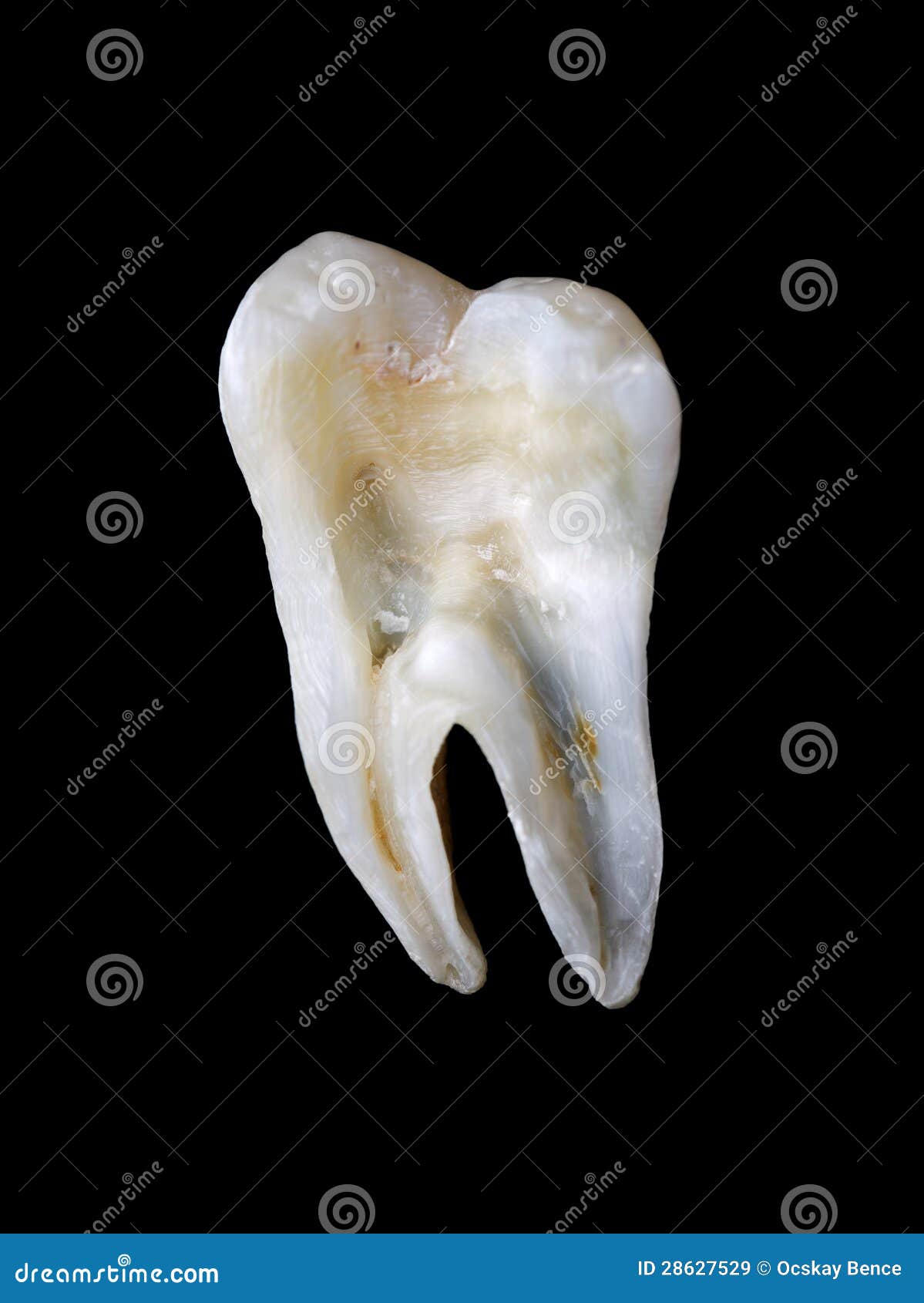 Section Longitudinale D'une Dent Humaine Image stock - Image du médical ...