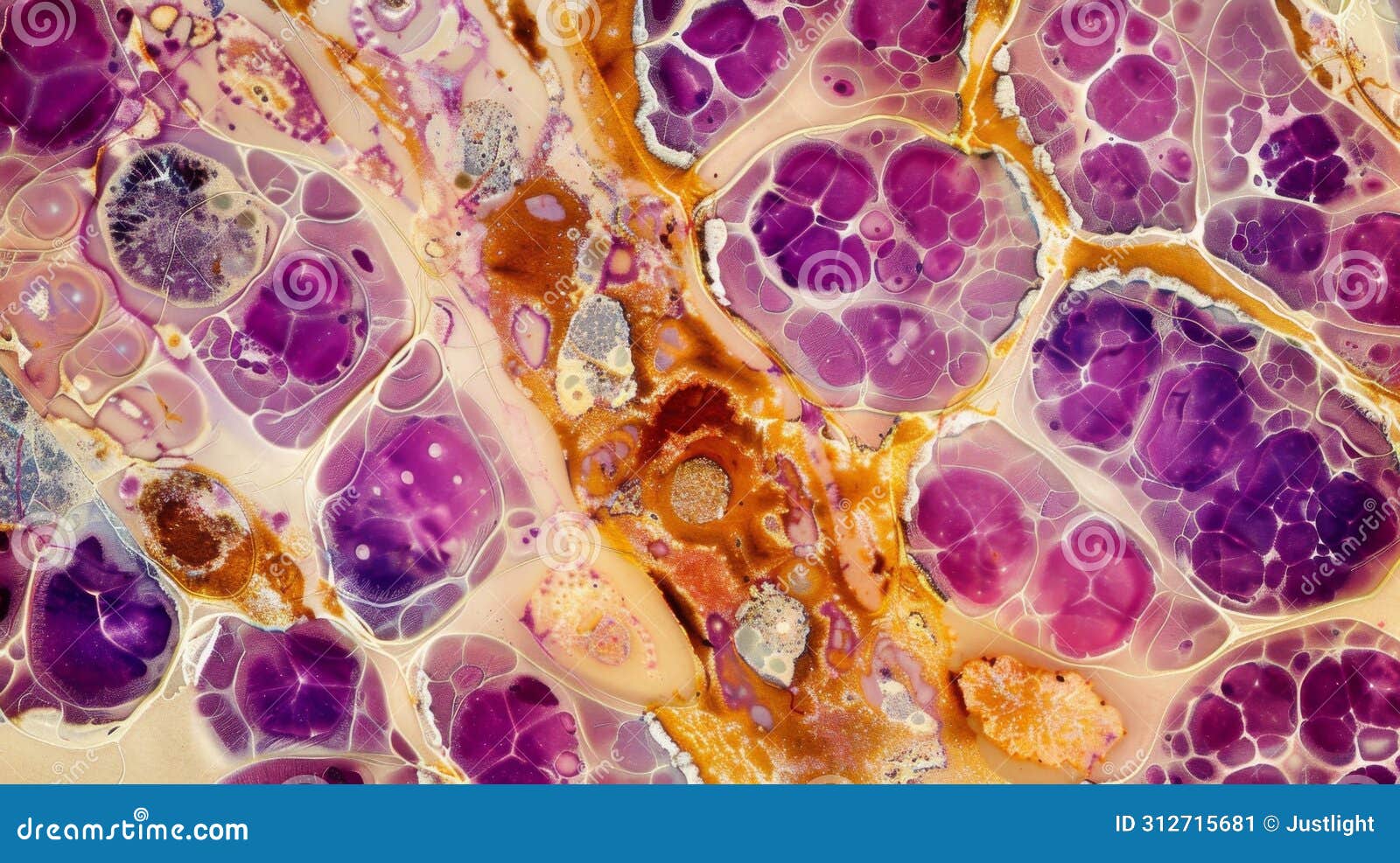 A Section of Lung Tissue Stained To Highlight the Different Types of ...